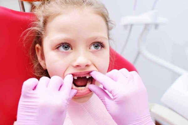 Hypodontia: Causes, Symptoms & More
